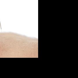 How acupuncture can help you lose weight or quit smoking