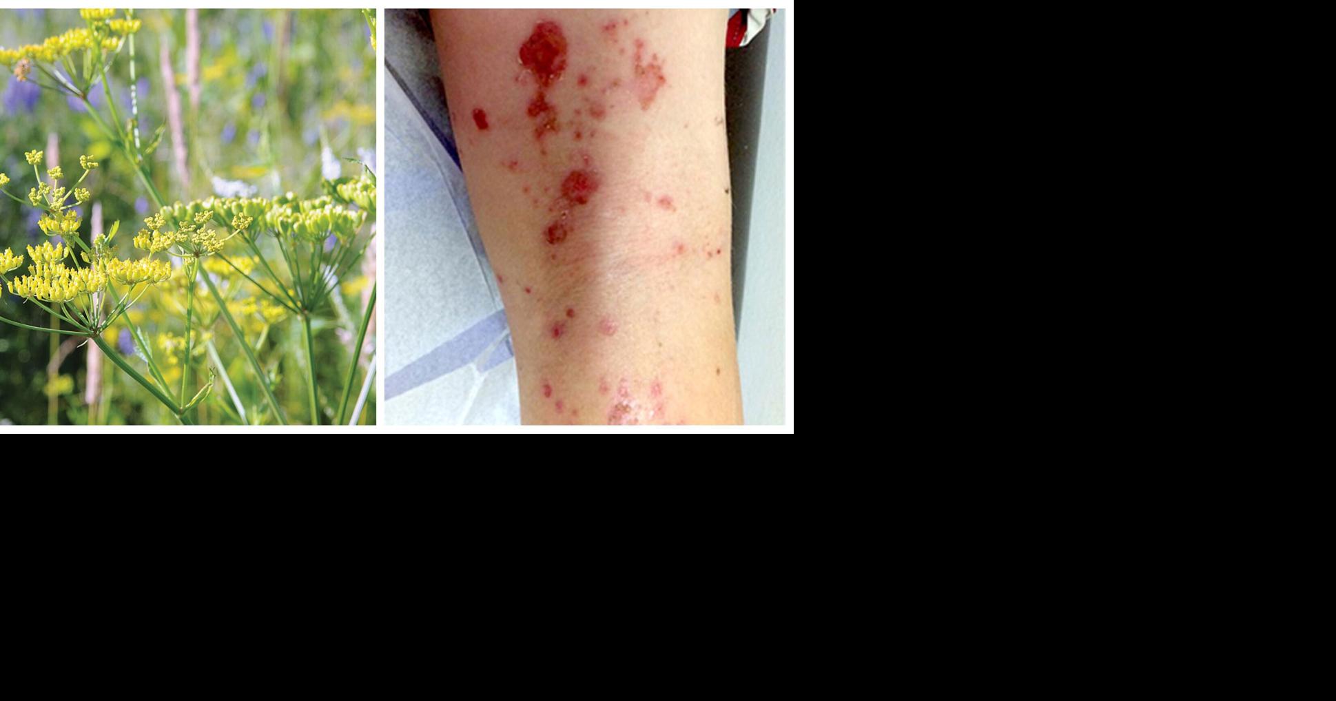 Top 7 most toxic plants found in Ontario