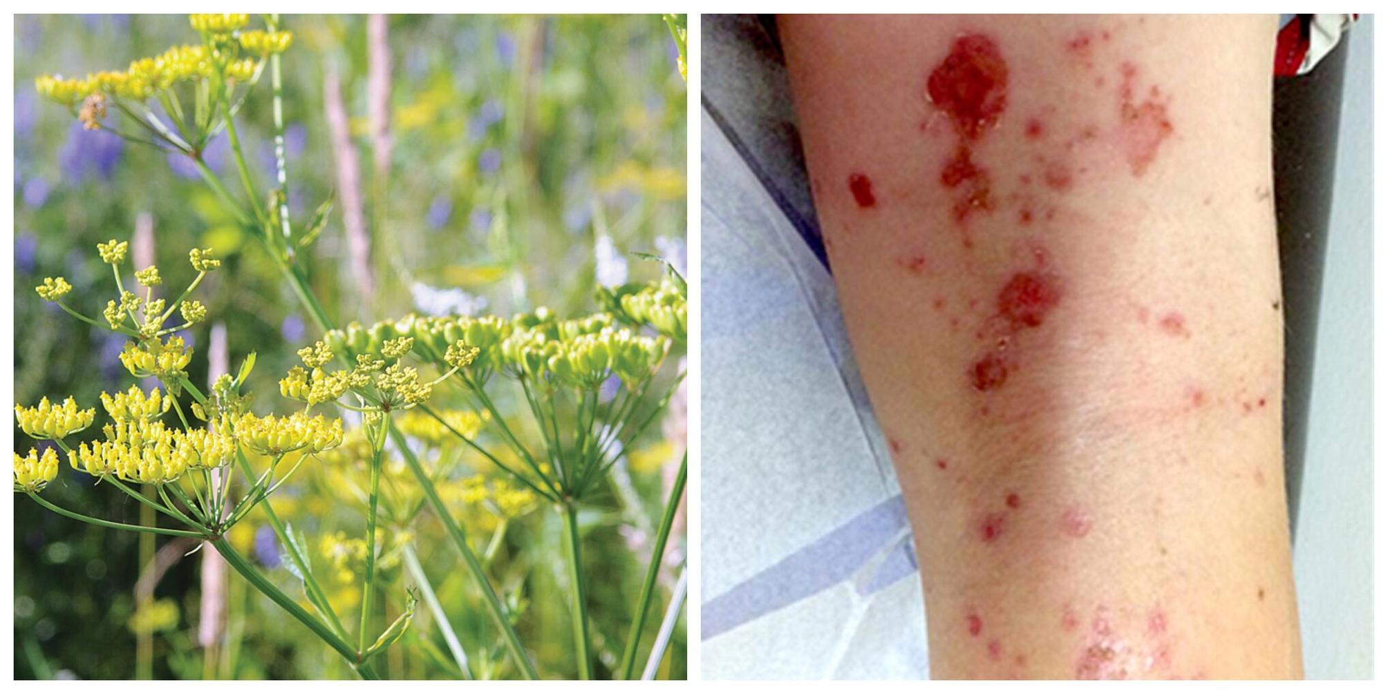 Top 7 most toxic plants found in Ontario