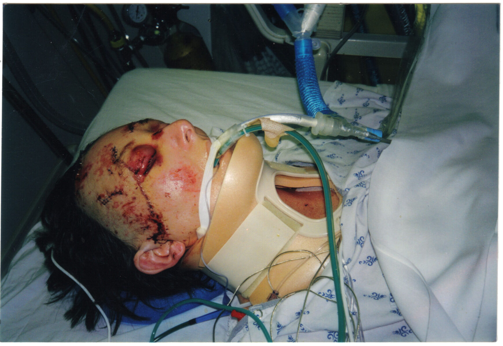 ‘The Adventures of Head Trauma Hero:’ Local author inspires hope for ...