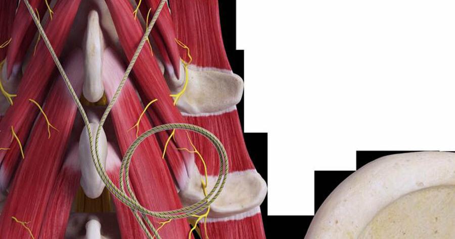 New treatment uses regenerative technology to combat low back pain ...