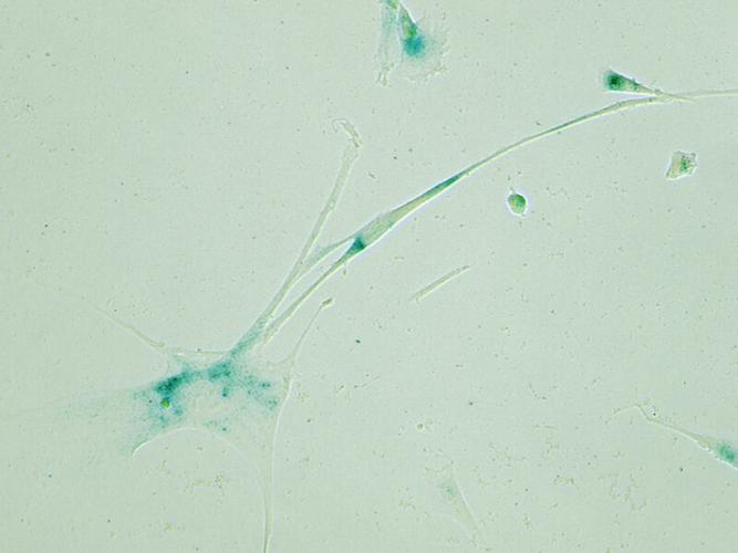 'Zombie cells' buildup in your body may play role in aging | National ...