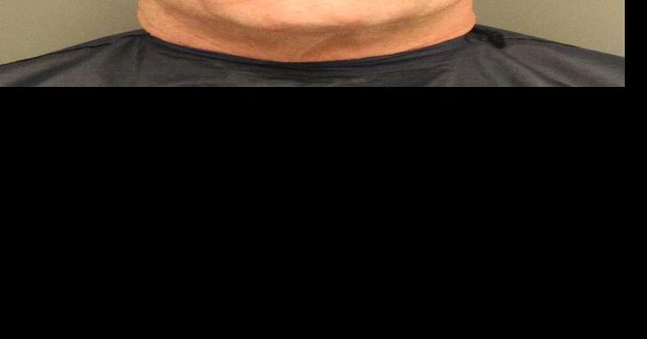 Lincoln man pleads guilty to Union Bank robbery