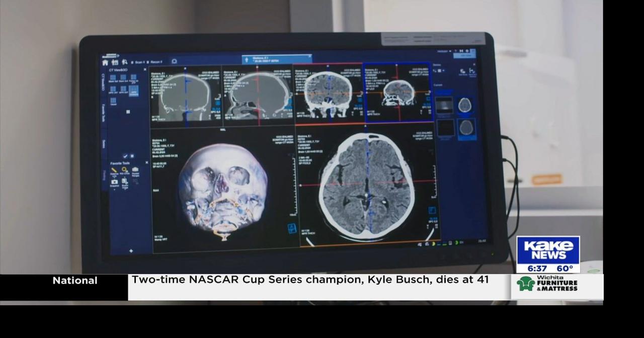 Stroke Awareness Month: Recognizing the signs of a stroke can save a ...