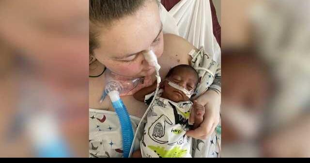 Doctors deliver baby early in effort to save child, mom who was near ...