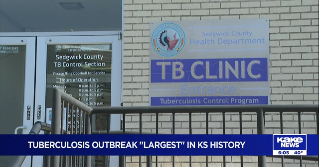 Kansas faces tuberculosis outbreak | News | kake.com