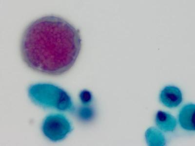 Arizona researchers look to control Valley Fever by targeting dust from ...