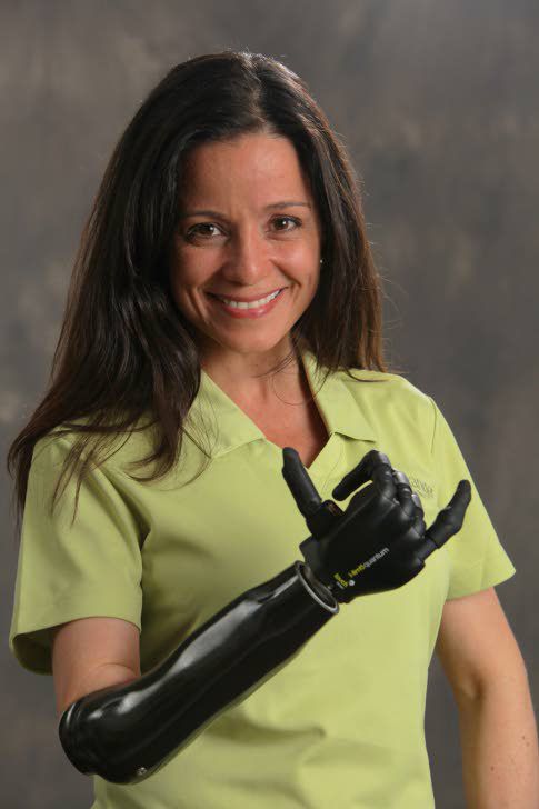 Bionic arm: Woman fitted with ‘i-limb’ appreciates every movement ...
