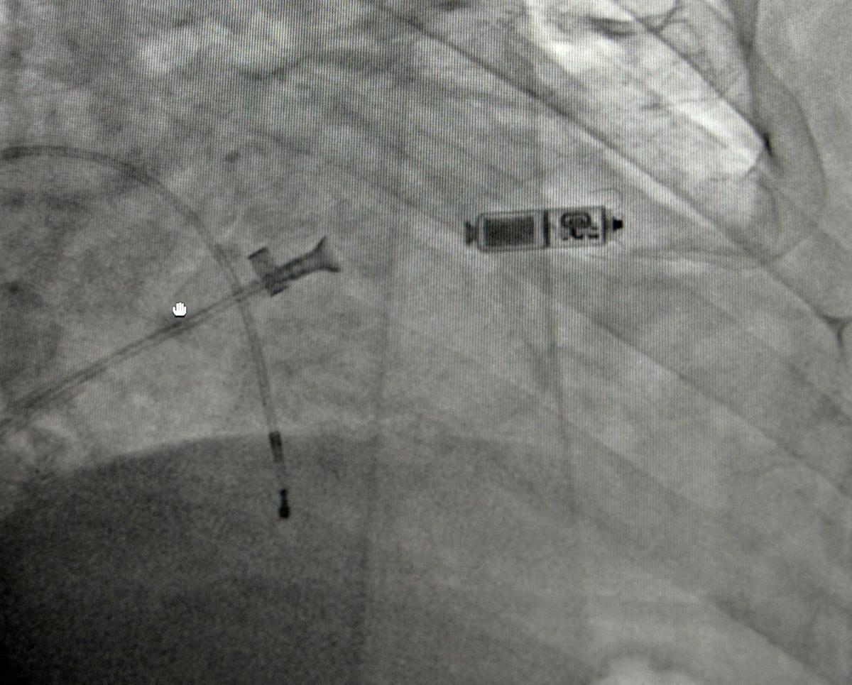 Cardiac innovations come to local hospital | Local News | kenoshanews.com