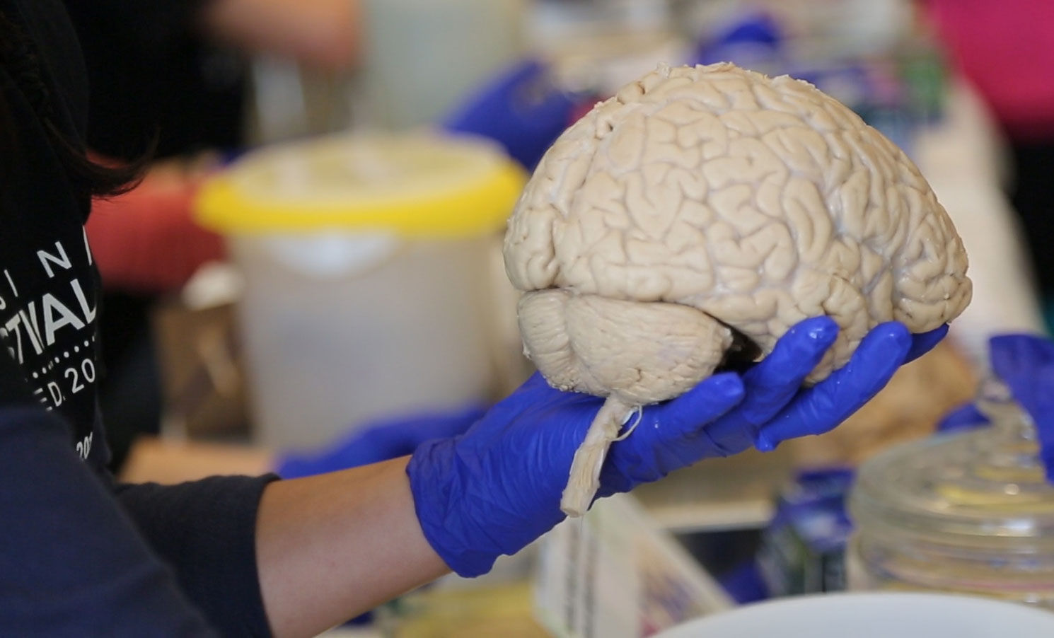 Blue Sky Science How Much Does A Human Brain Typically Weigh State Blue Sky Science How Much Does A Human Brain Typically Weigh State