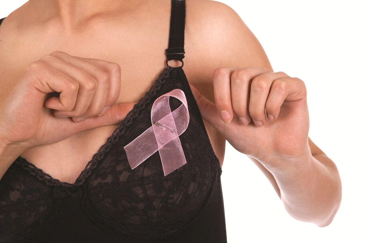 Enhanced Breast Cancer Detection: RadNet’s AI-Powered gives providers ...