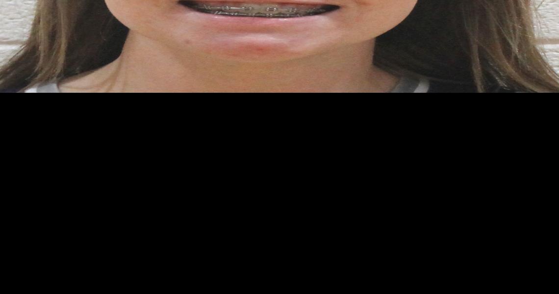 OSU-bound Sheldon leads Coffman past Lady Chiefs | Sports | logandaily.com