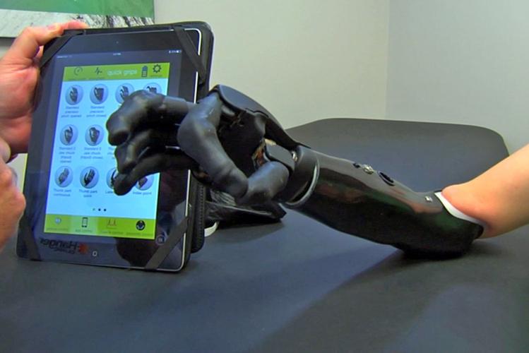 i limb quantum bionic hands