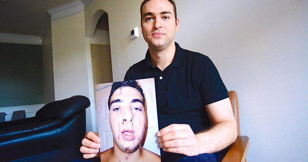 ‘Can You See My Scars?’: Samuel Moore-Sobel Tackles Scars—Seen and ...