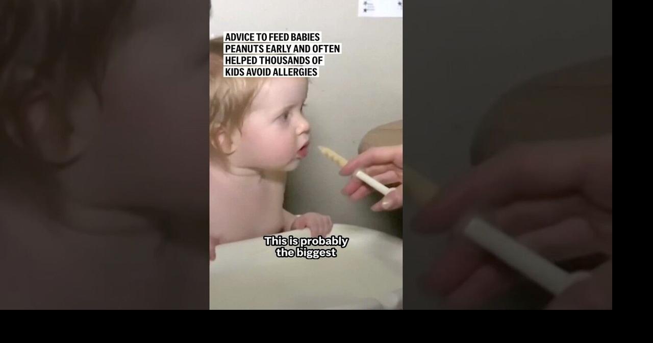 Advice to feed babies peanuts early and often helped thousands of kids ...