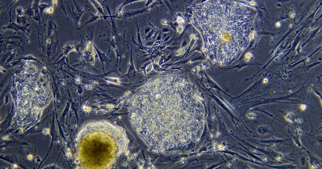Madison in 100 objects: 4. Stem cells