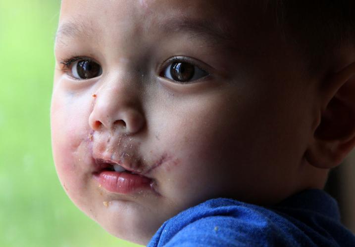 Family of baby injured during raid awarded $3.6 million