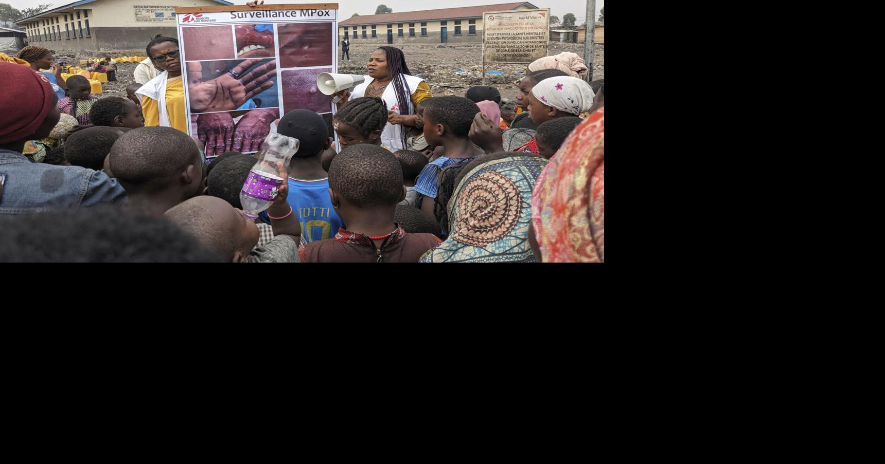 A closer look at latest mpox outbreak