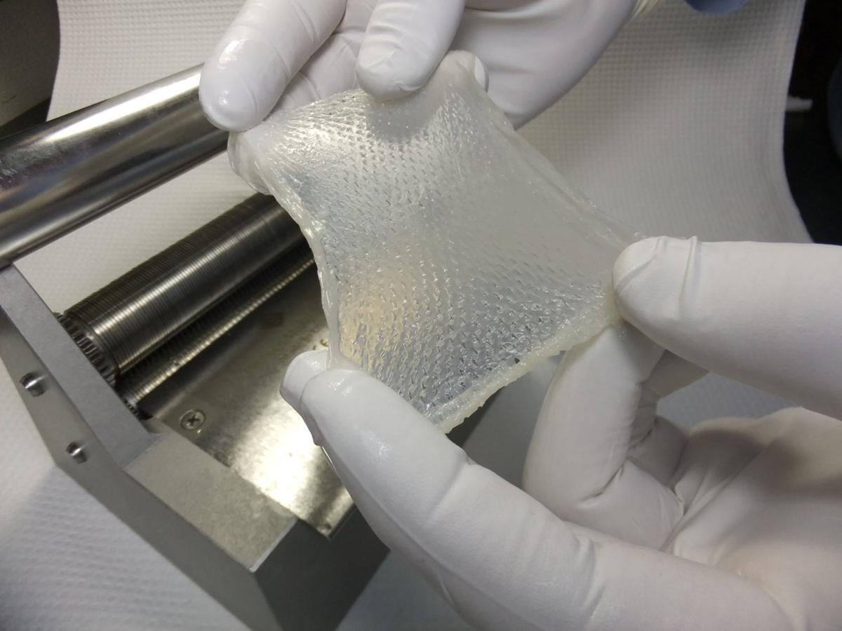 Madison-made skin tissue ExpressGraft begins human tests to treat ...