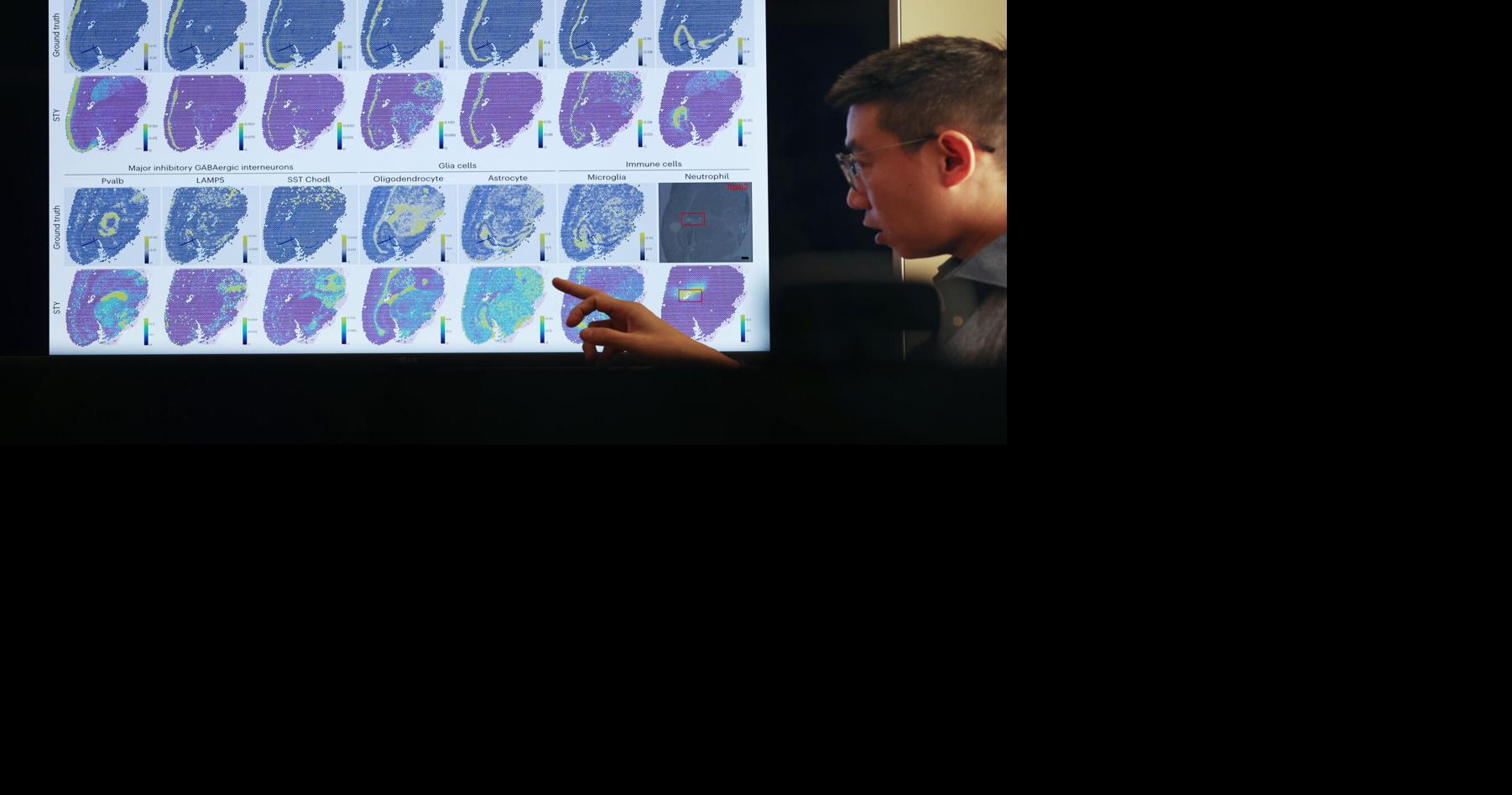 UW-Madison professor's AI tool is inspired by his son's story