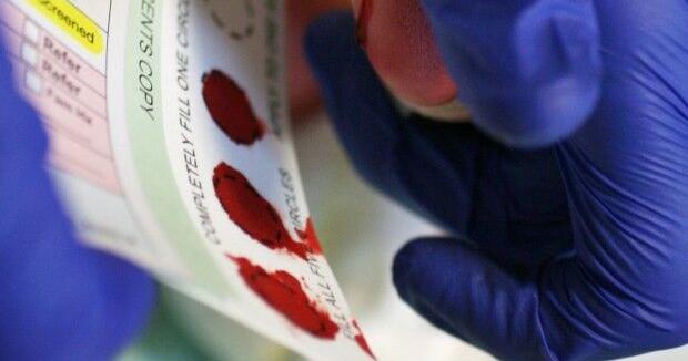 Wisconsin halts plan to keep newborn screening samples for 10 years