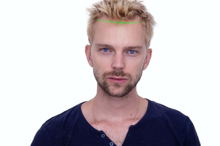 2024 Top 10 Best Hair Transplants In Turkey And Costs