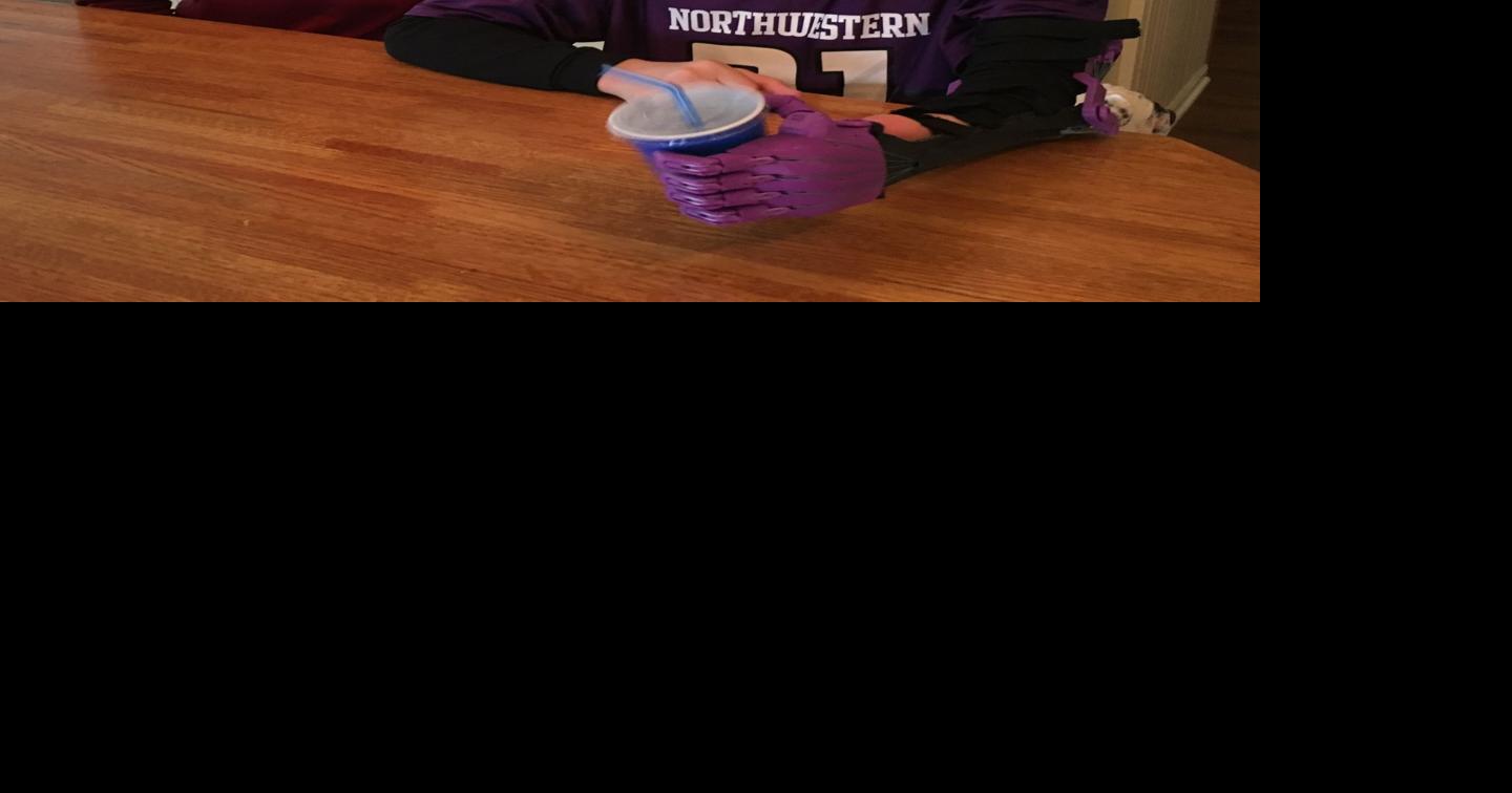 Stoughton teen creates prosthetic hand for 11-year-old