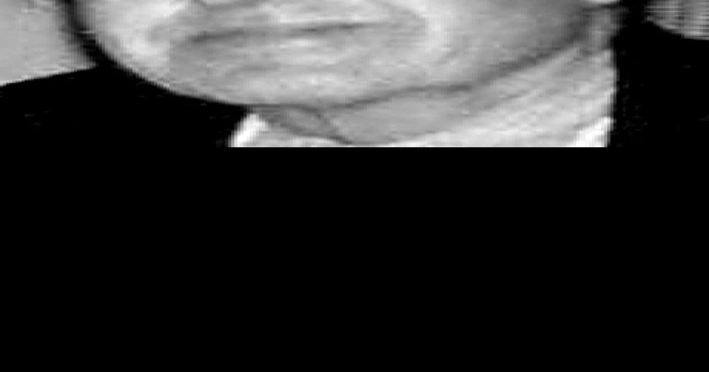 Terry, Peter Donahoe