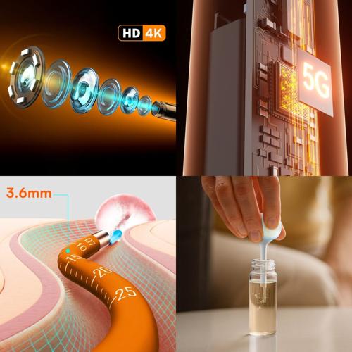 Bebird Launches EarSight Ultra X: The 5G-Powered Ear Care Solution for ...