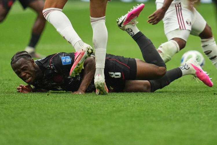 Canada's Ismaël Koné has surgery for 2 broken bones in leg from World ...