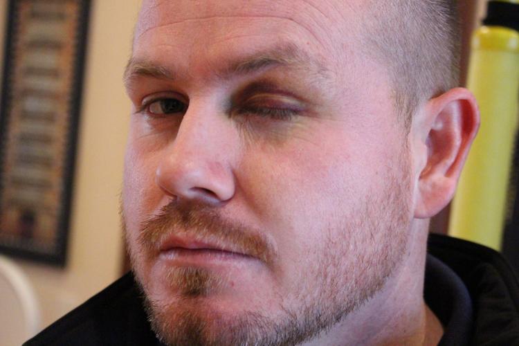 Kaleb Whitby, Crushed Between Semis, Tells Story of Survival