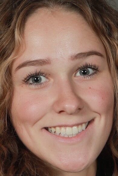 Gustavus teammates carry on for injured Olinger | Local Sports ...