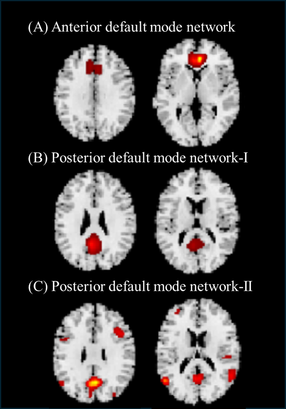 Study finds vitamin C boosts brain health in older adults | Health ...