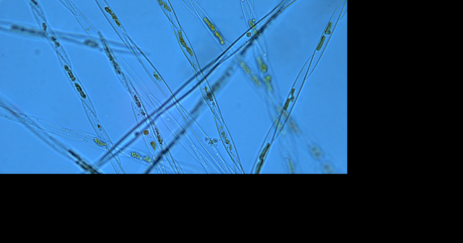 New method will track toxic algae before widespread blooms | Maritime ...