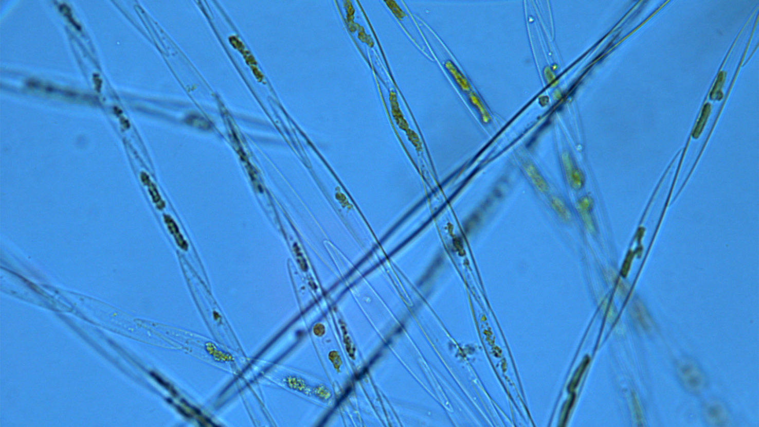 New method will track toxic algae before widespread blooms | Maritime ...