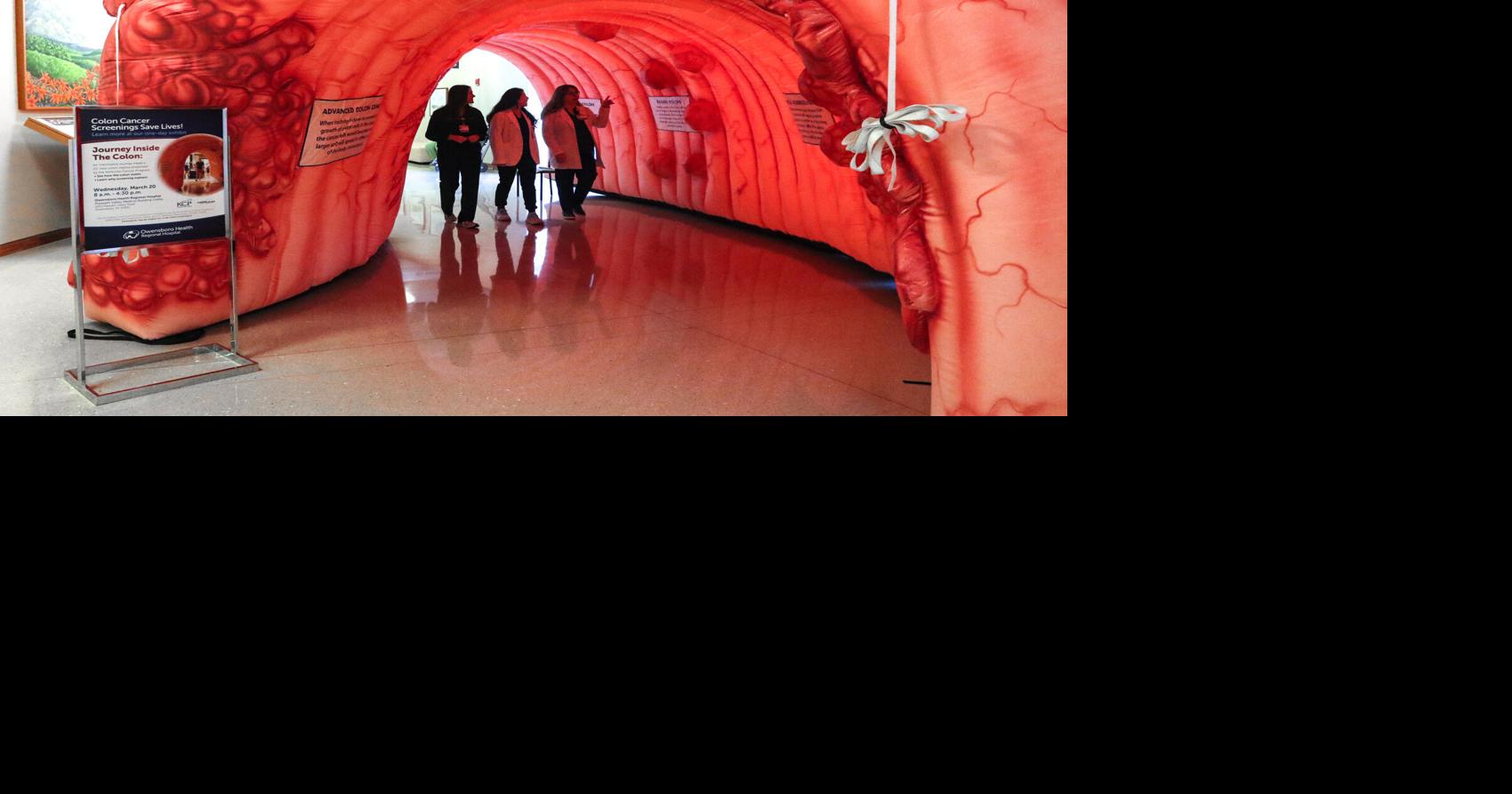 'When in doubt, check it out': OH, KCP team up for colon cancer ...