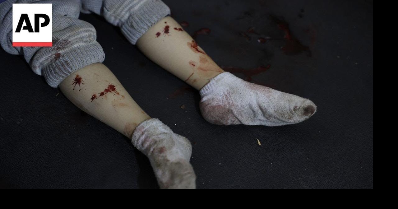 Syrian government forces and Kurdish fighters clash in Aleppo, injuring ...