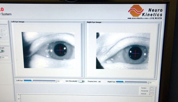 Brain trust: Eye movement test assists in diagnosis of concussion