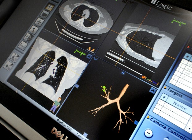 New-generation sensor, technology allow Missoula surgeons to better ...