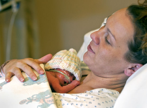 Rare, one in 10,000 monoamniotic twins born at Missoula hospital