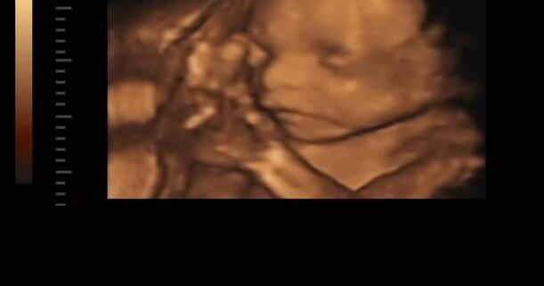 MMH Alpine Women’s Centre offers new view of babies in the womb | Local ...