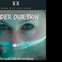 Lyme disease documentary to be shown Nov. 22 | | moraminn.com