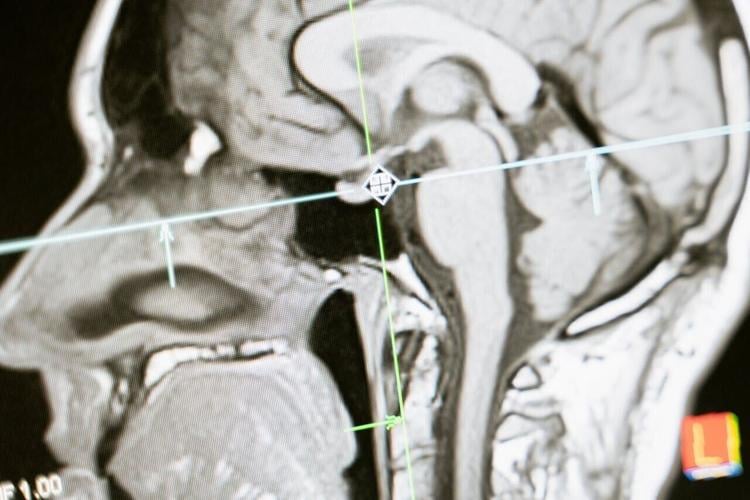 Vaccine offers new hope against incurable brain cancer | Health ...