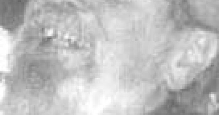 Dr. Michael Poole, 72