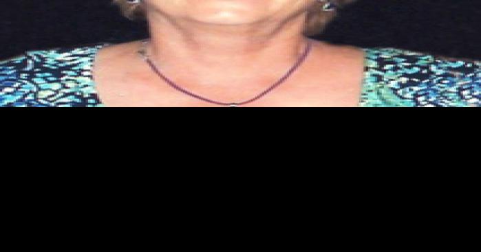 Alma “Beth” McDermott, 69