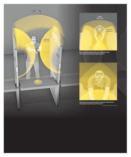 Target Shooting Could Be Causing Brain Injuries | Lifestyle ...