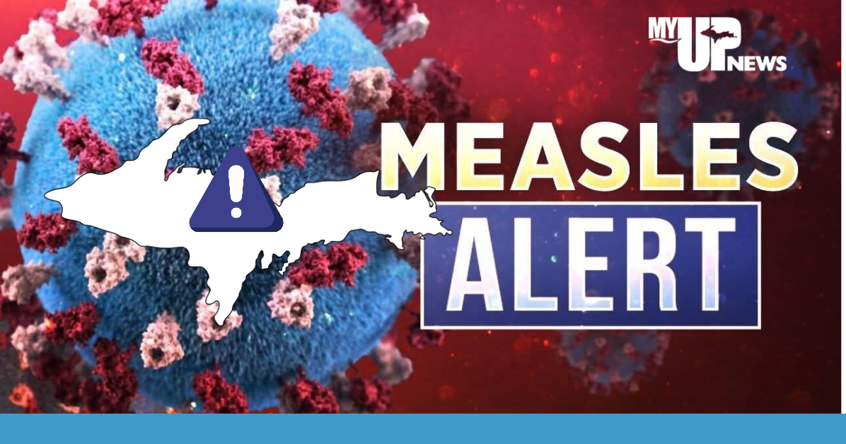 2nd measles case confirmed in Upper Peninsula: Where you may have been ...
