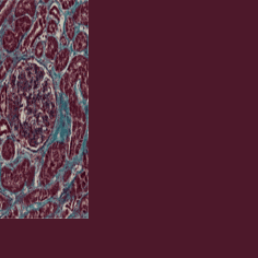 COVID-19 directly damages, creates scar tissue on the kidneys, study ...