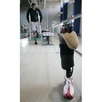 U.S. soldiers with missing limbs are being allowed to return to active ...