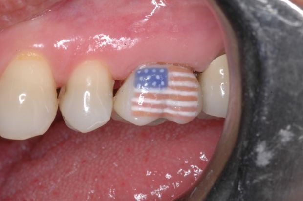 A smile worth a thousand words